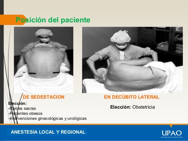 3.anestesia epidural