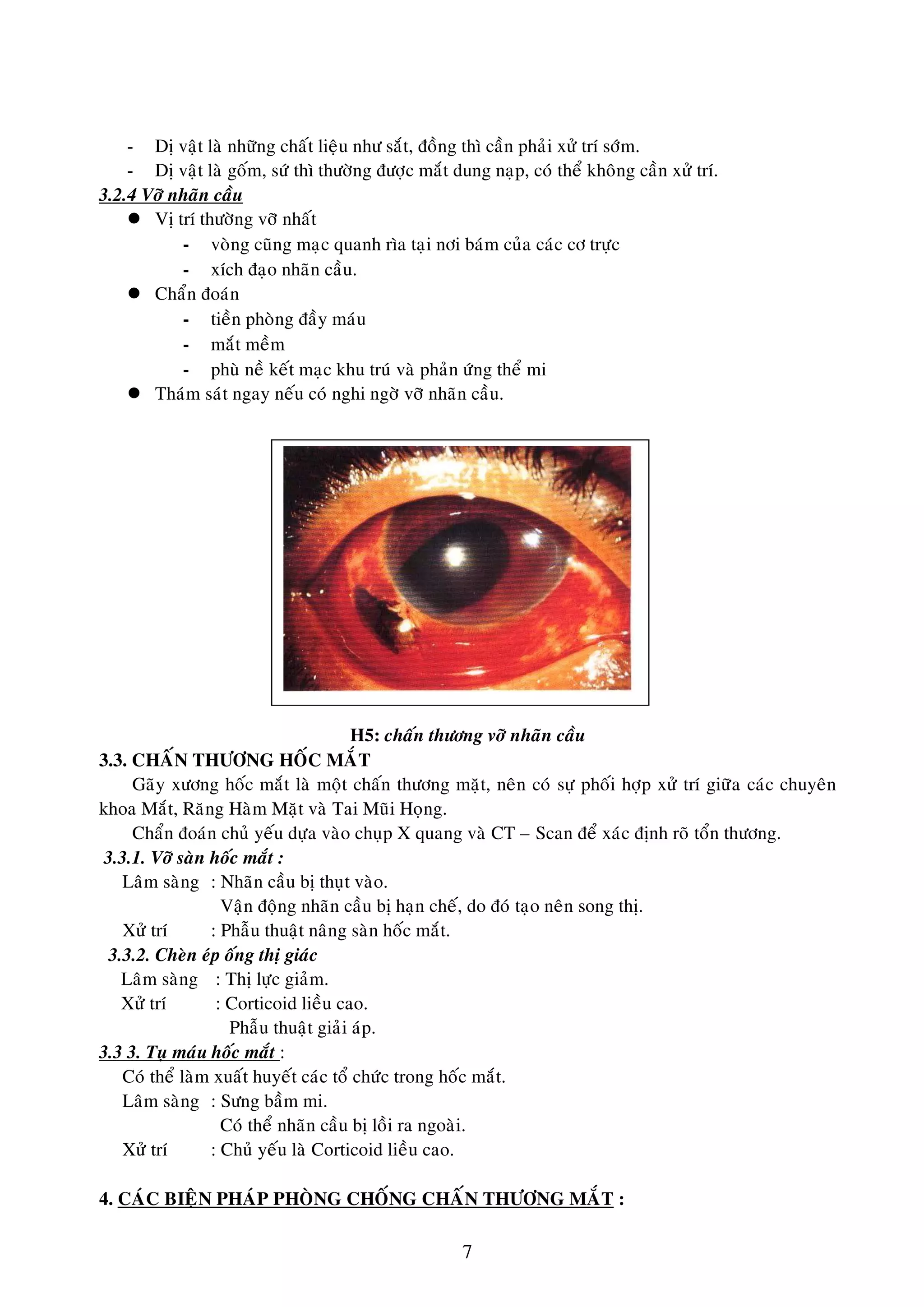 CHẤN THƯƠNG MẮT | PDF
