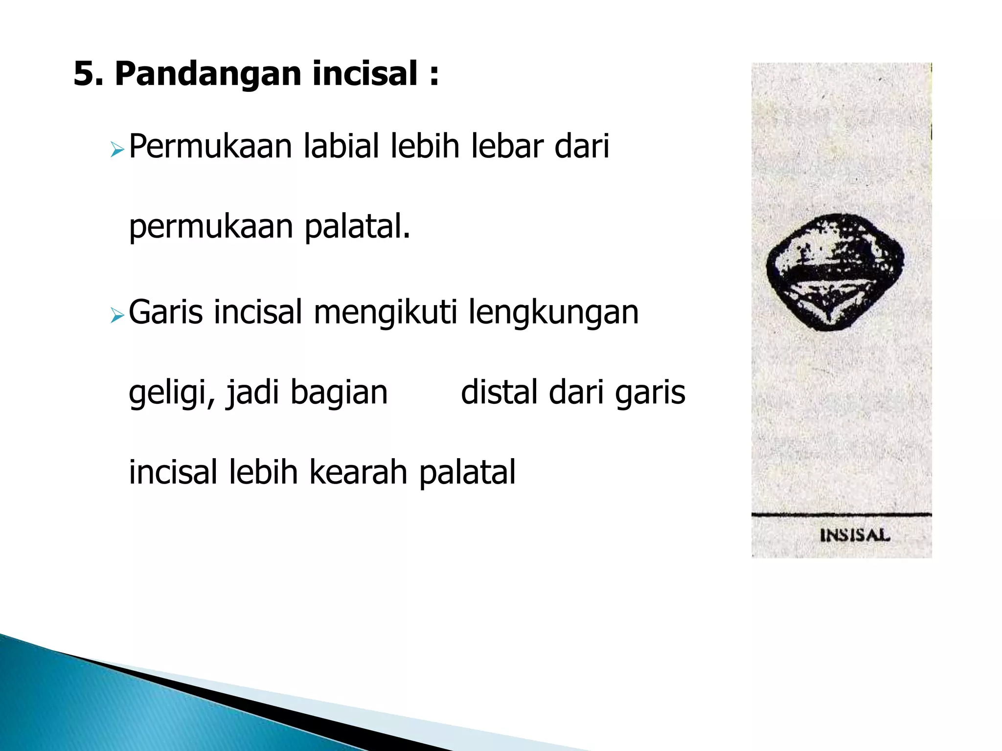 3. anatomi gigi insisivus kedua atas & bawah | PPTX