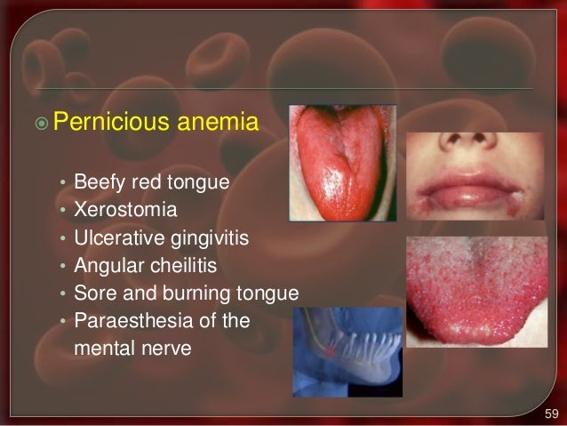 3.blood and its current concepts in coagulation