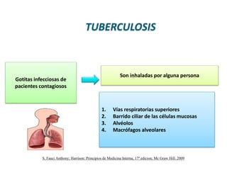 Tuberculosis | PPTX