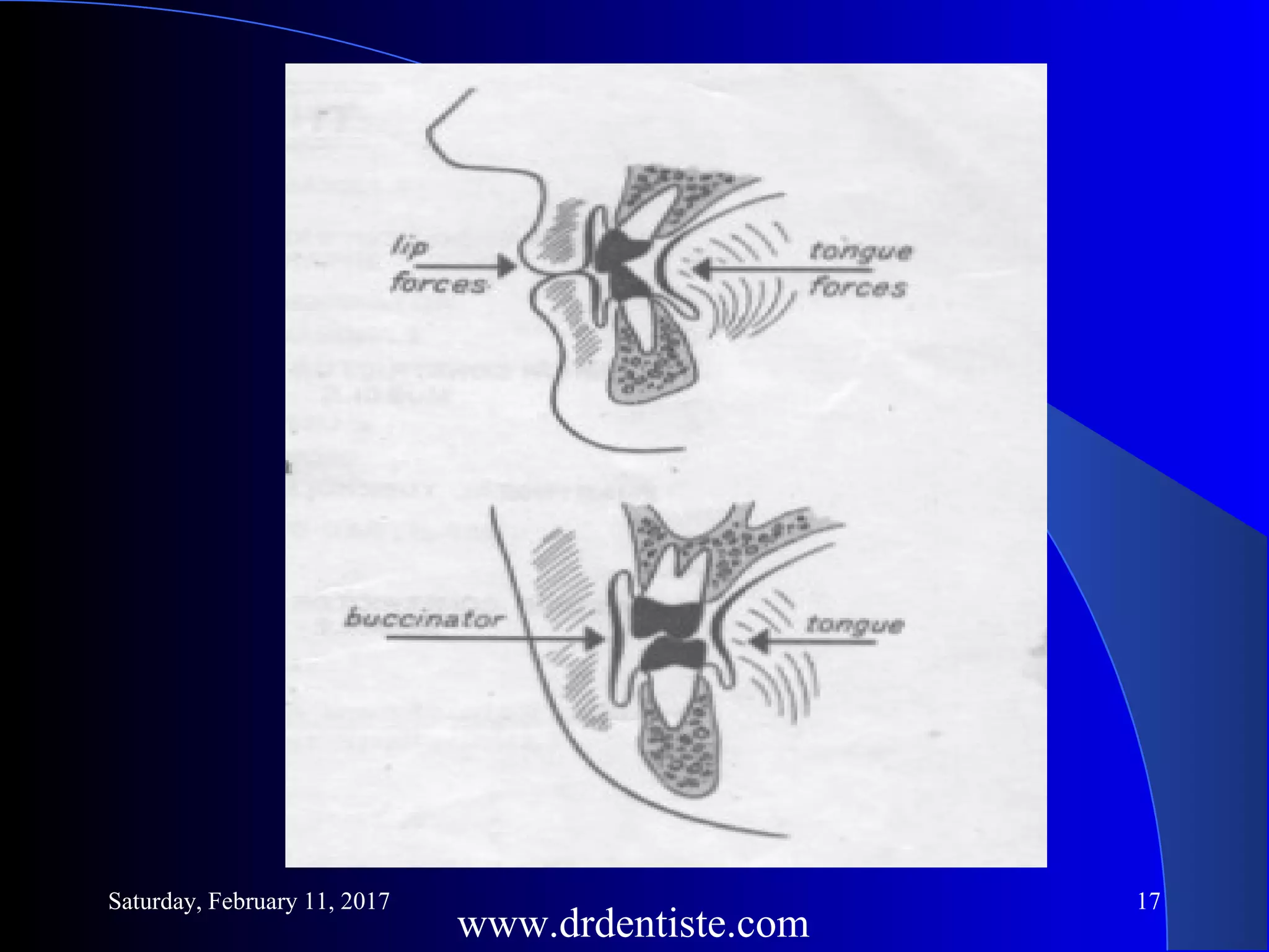 buccinator mechanism | PPT