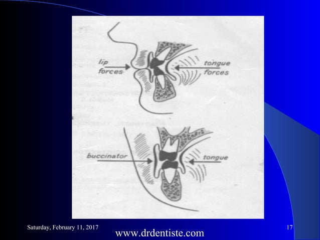 buccinator mechanism | PPT | Dental Health | Diseases and Conditions