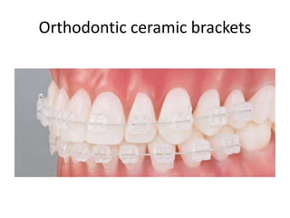 History of dental ceramics | PPTX