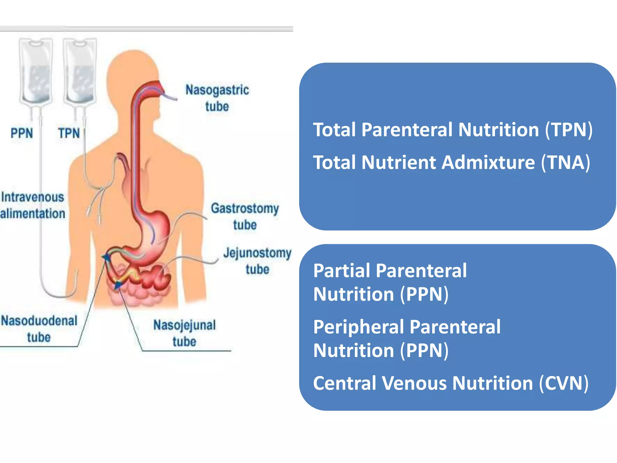Parenteral Nutrition for the oral and maxillofacial surgery patient | PPTX