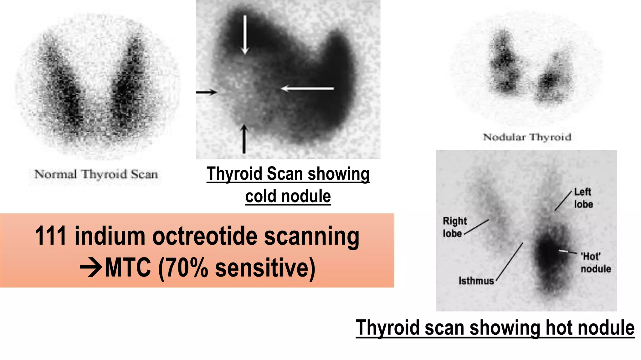 3.clinical diagnosis & investigation in a case of thyroid swelling | PPTX