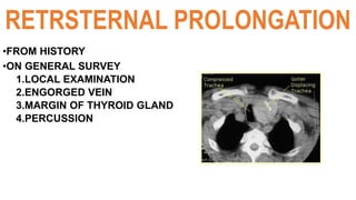 3.clinical diagnosis & investigation in a case of thyroid swelling | PPTX
