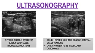 3.clinical diagnosis & investigation in a case of thyroid swelling | PPTX