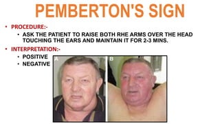 3.clinical diagnosis & investigation in a case of thyroid swelling | PPTX