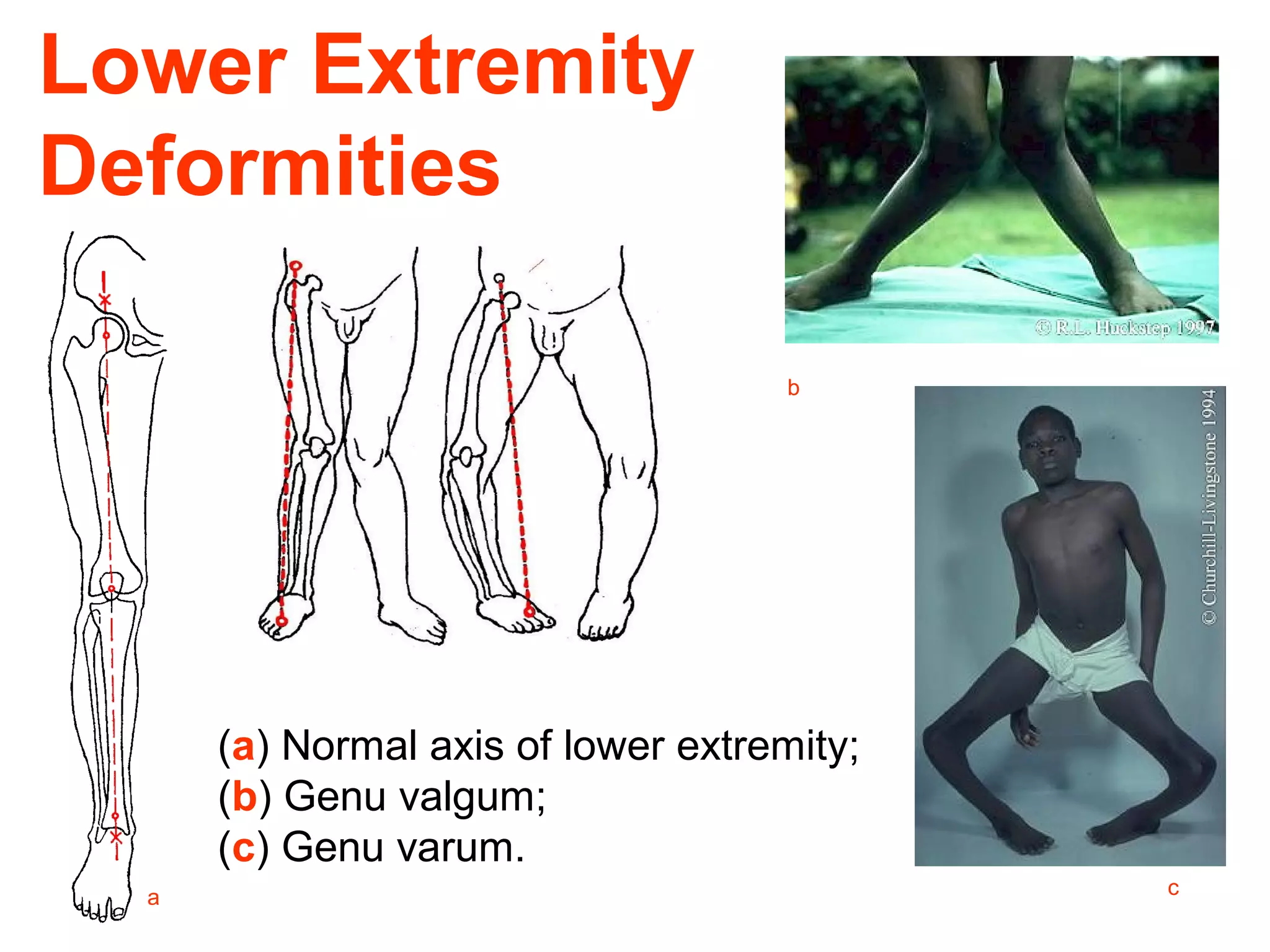 Examination of Orthopedic patients | PPT
