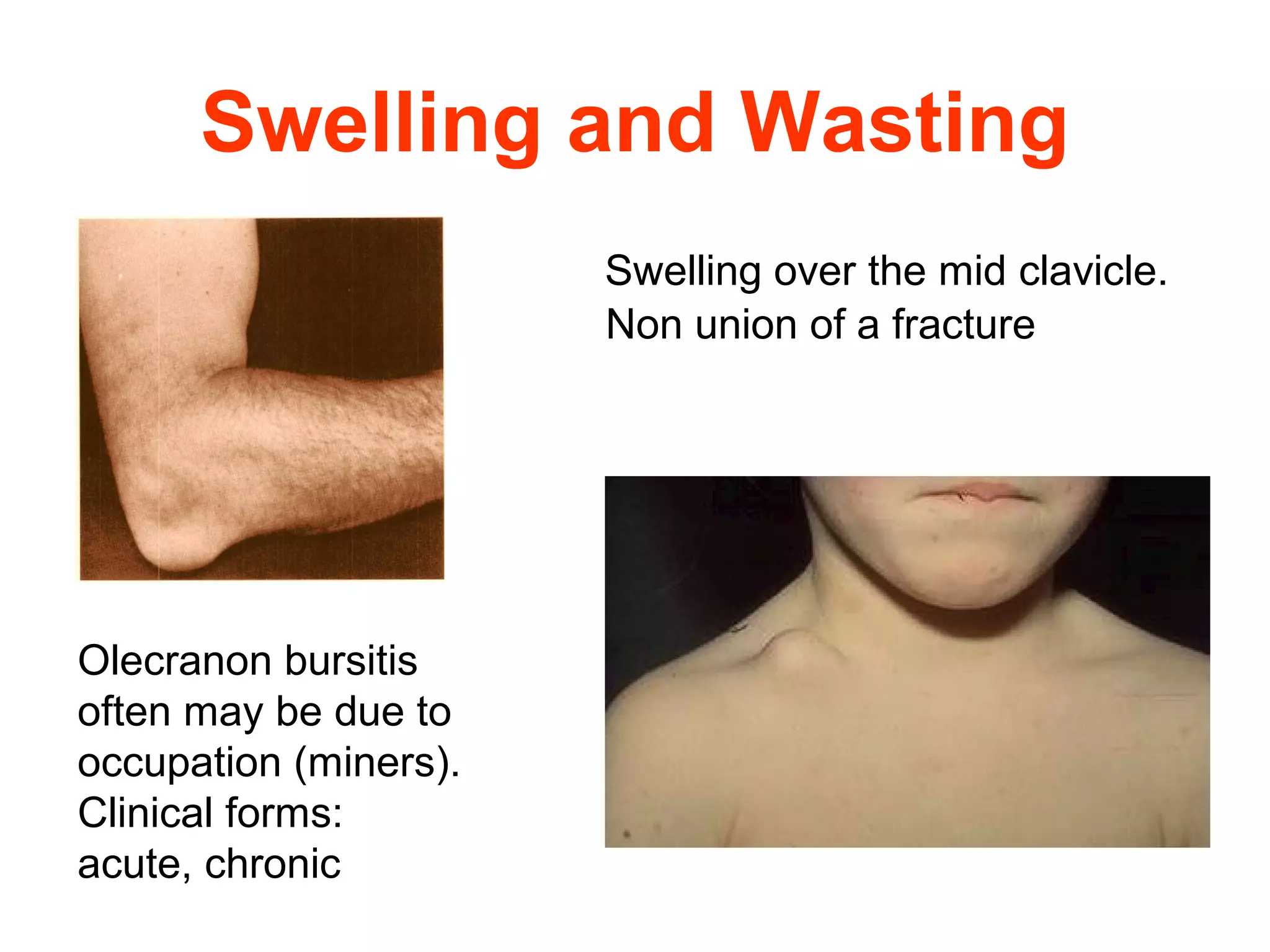 Examination of Orthopedic patients | PPT