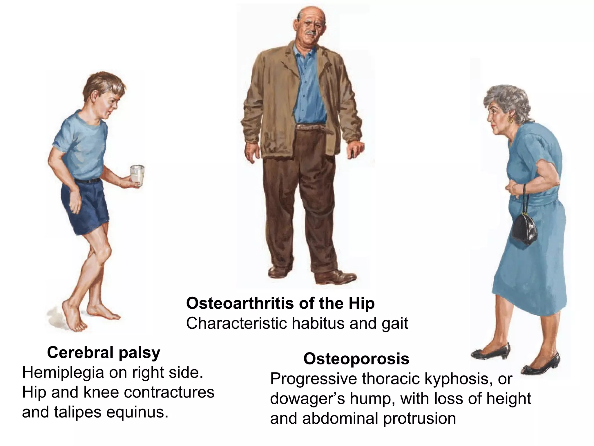 Examination of Orthopedic patients | PPT