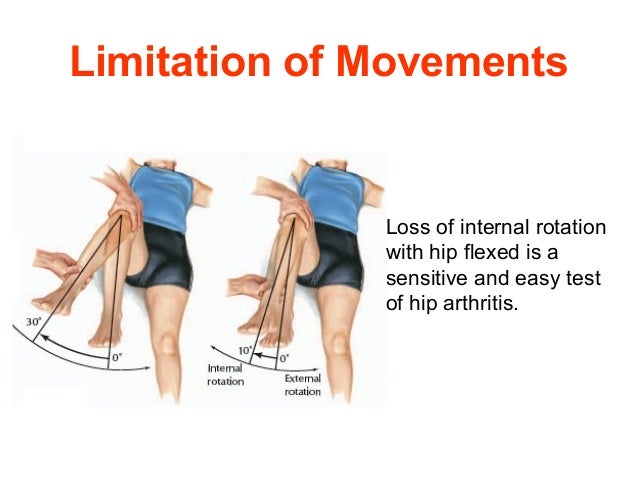 Examination of Orthopedic patients