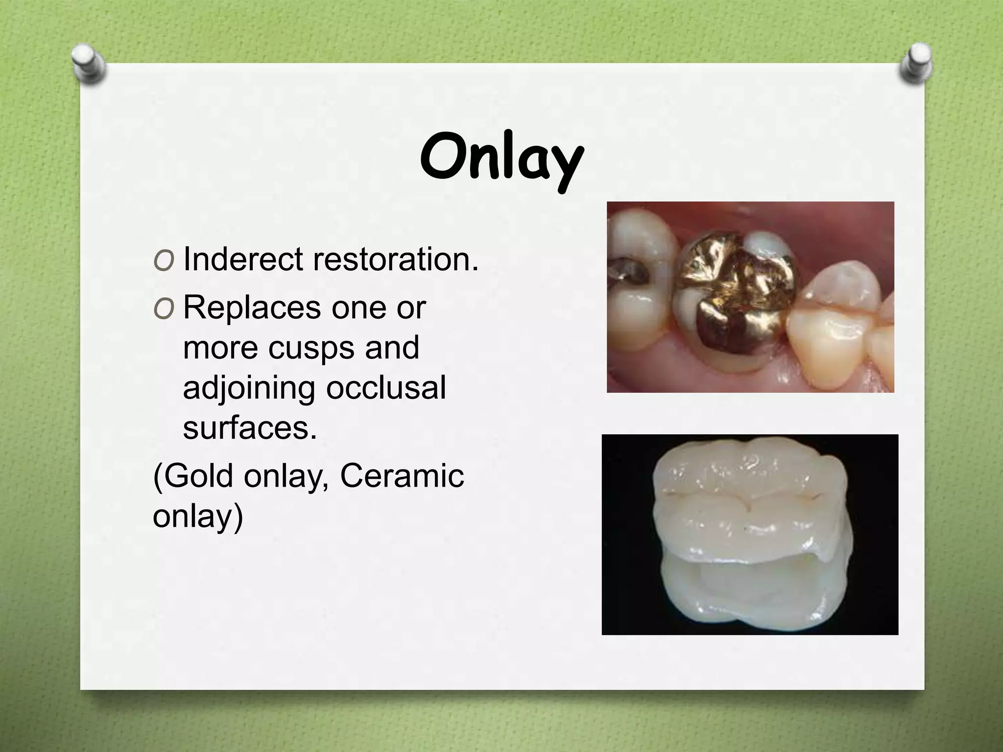 Dental Restorations | PPTX