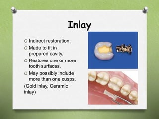 Dental Restorations | PPTX