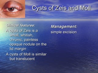 Diseases of Eyelids, Lacrymal system & Orbit | PPT