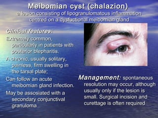 Diseases of Eyelids, Lacrymal system & Orbit | PPT