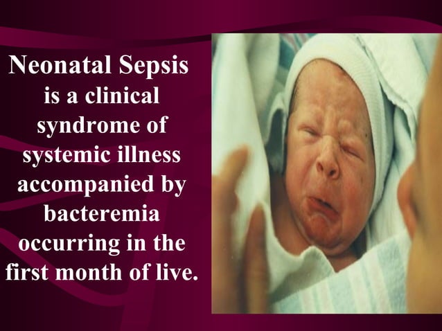 Bacterial infection in Newborns.Neonatal sepsis