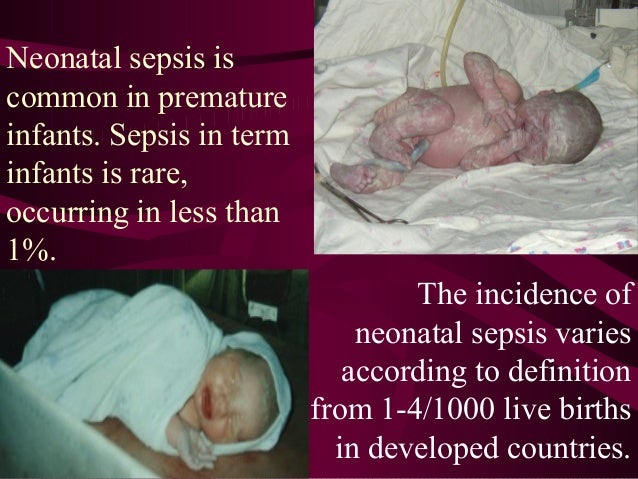 Bacterial infection in Newborns.Neonatal sepsis