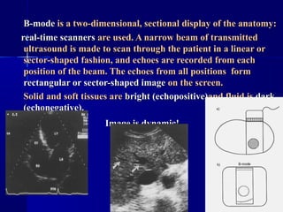 Ultrasound & MRI method of examination | PPT