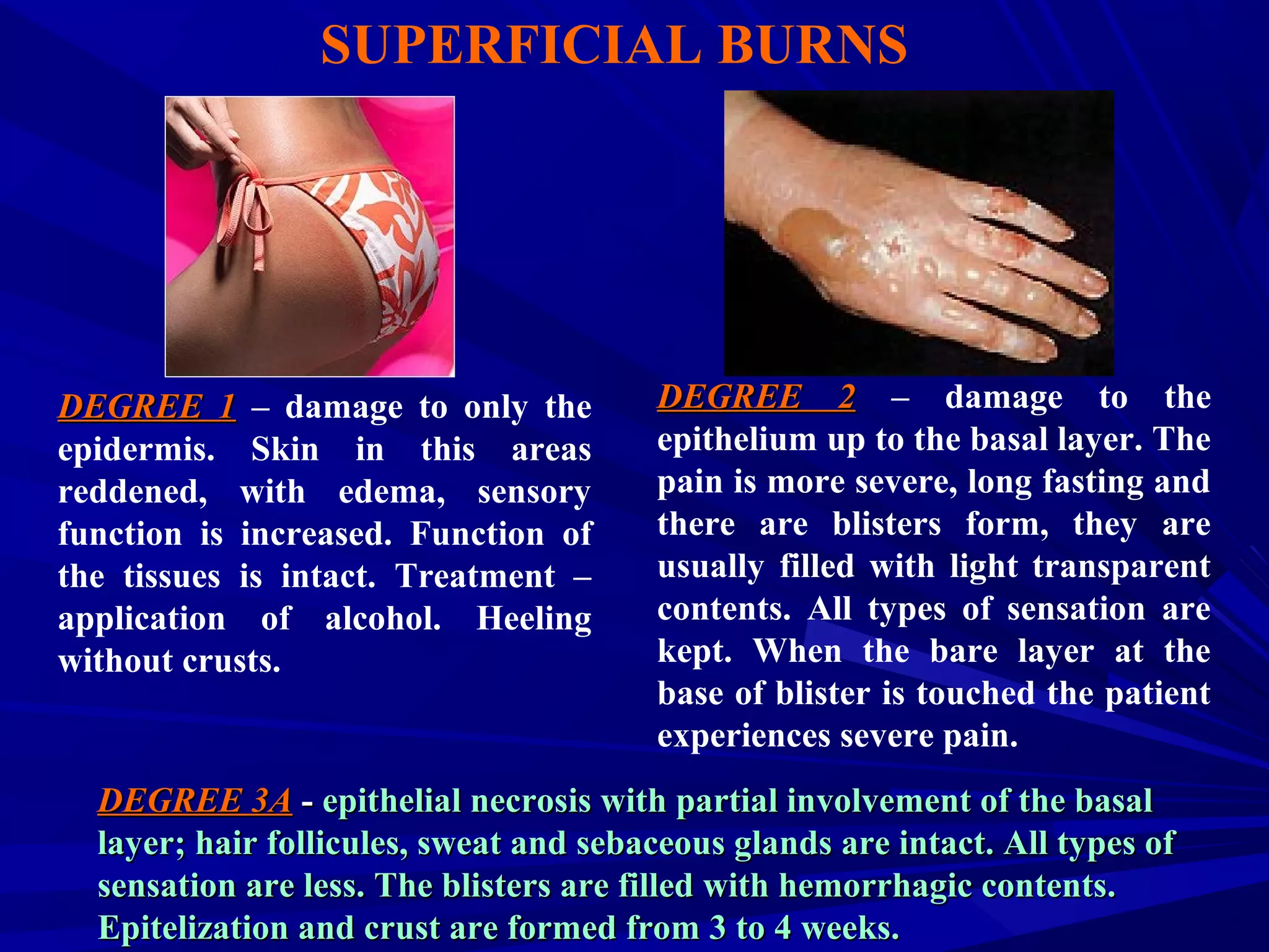 Thermal Trauma. Burns, Electrical Trauma, Frost Bite | PPT