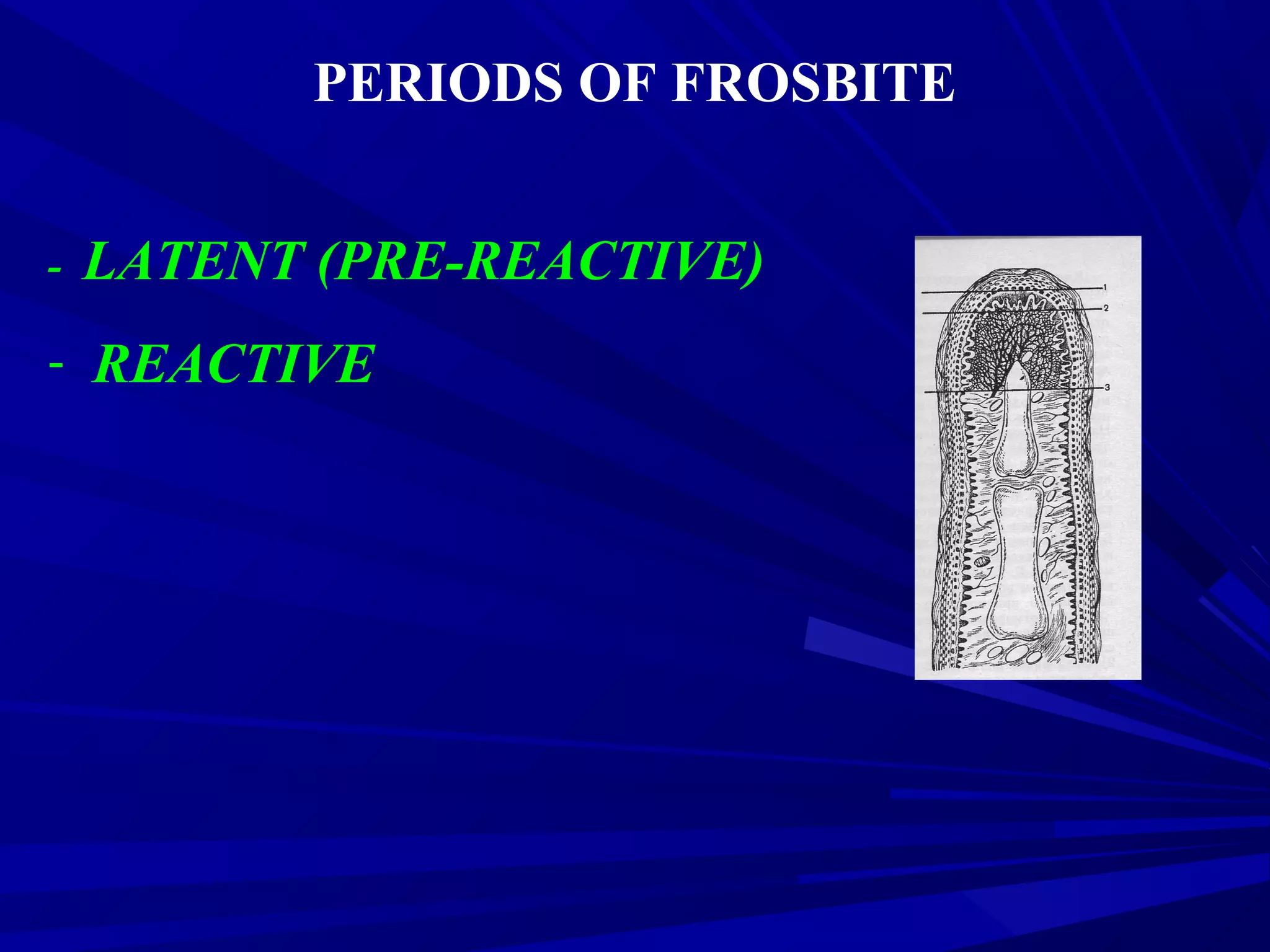 Thermal Trauma. Burns, Electrical Trauma, Frost Bite | PPT