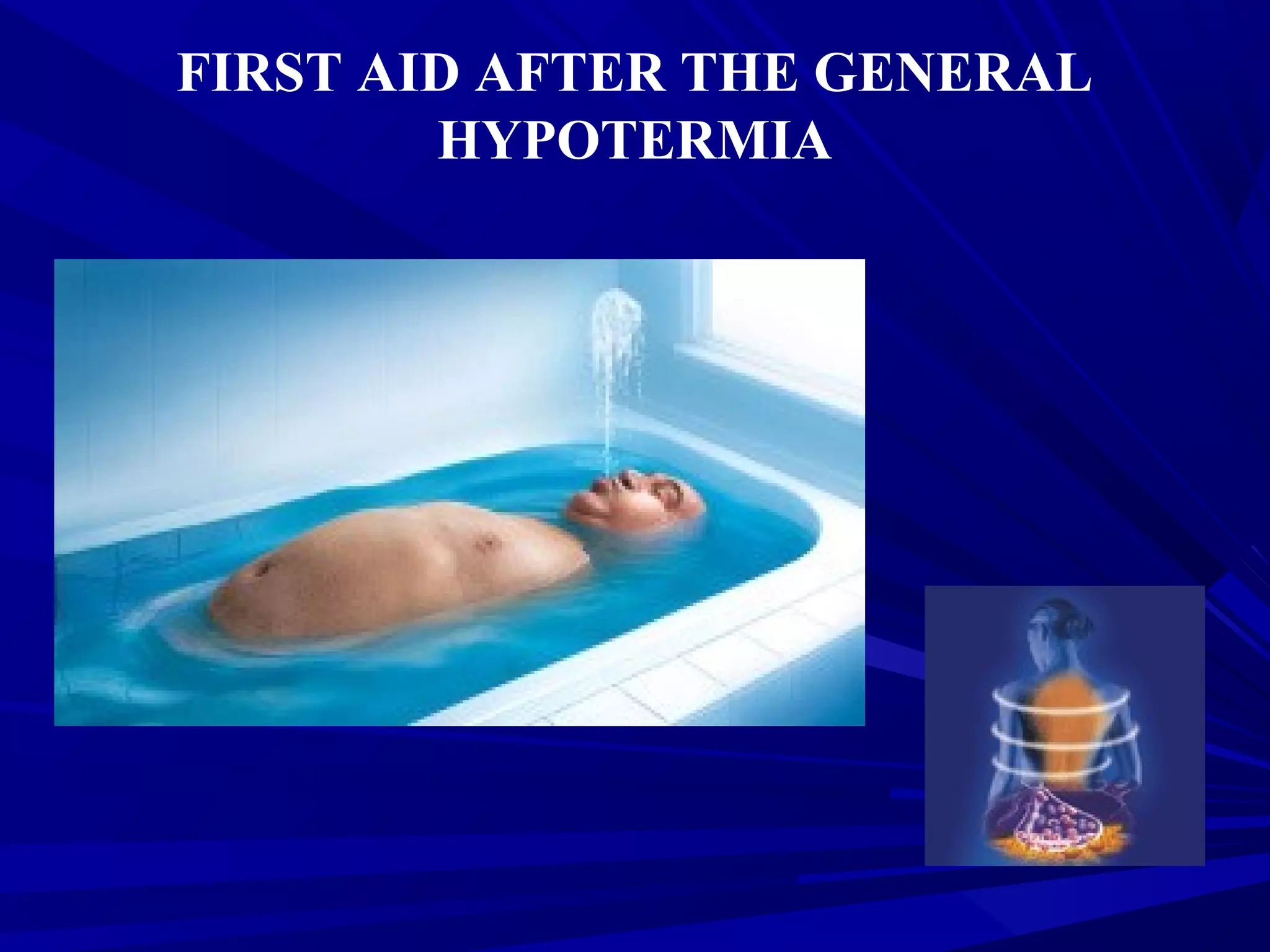 Thermal Trauma. Burns, Electrical Trauma, Frost Bite | PPT