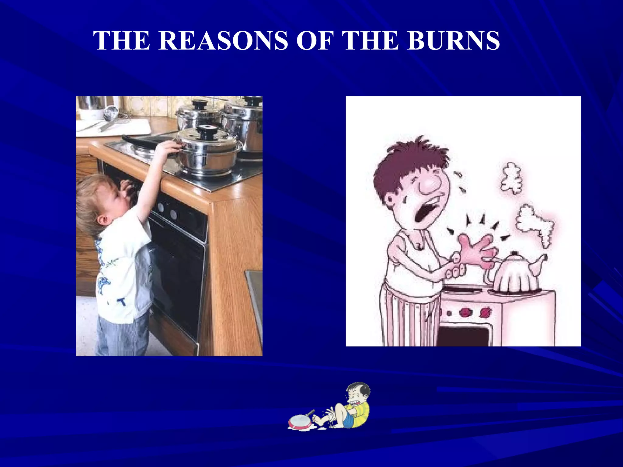 Thermal Trauma. Burns, Electrical Trauma, Frost Bite | PPT