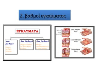 3η συναντηση εγκαυματα- Πρώτες βοήθειες | PPT
