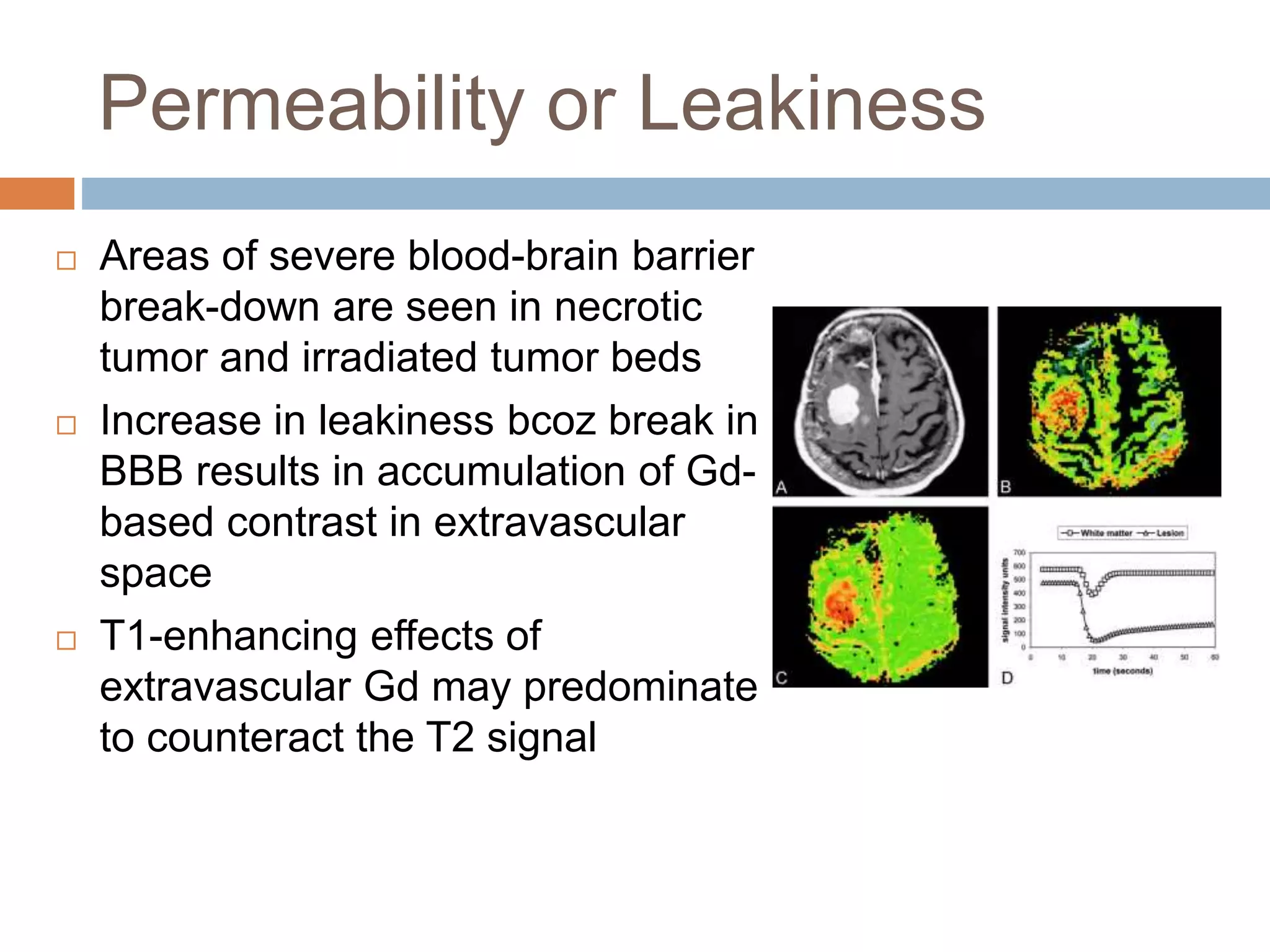 Magnetic Resonance Perfusion | PPTX