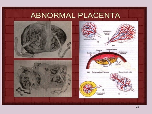 PLACENTA | PPT | Pregnancy | Reproductive Health