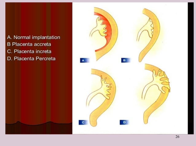 PLACENTA | PPT | Pregnancy | Reproductive Health