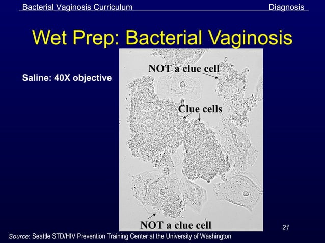 SS 2017: Diagnosis of Vaginal Conditions | PPT