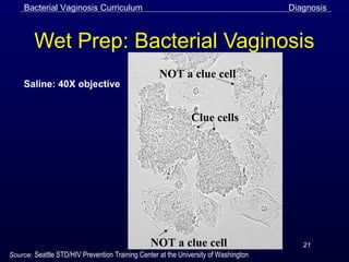 Bacterial Vaginosis Wet Mount