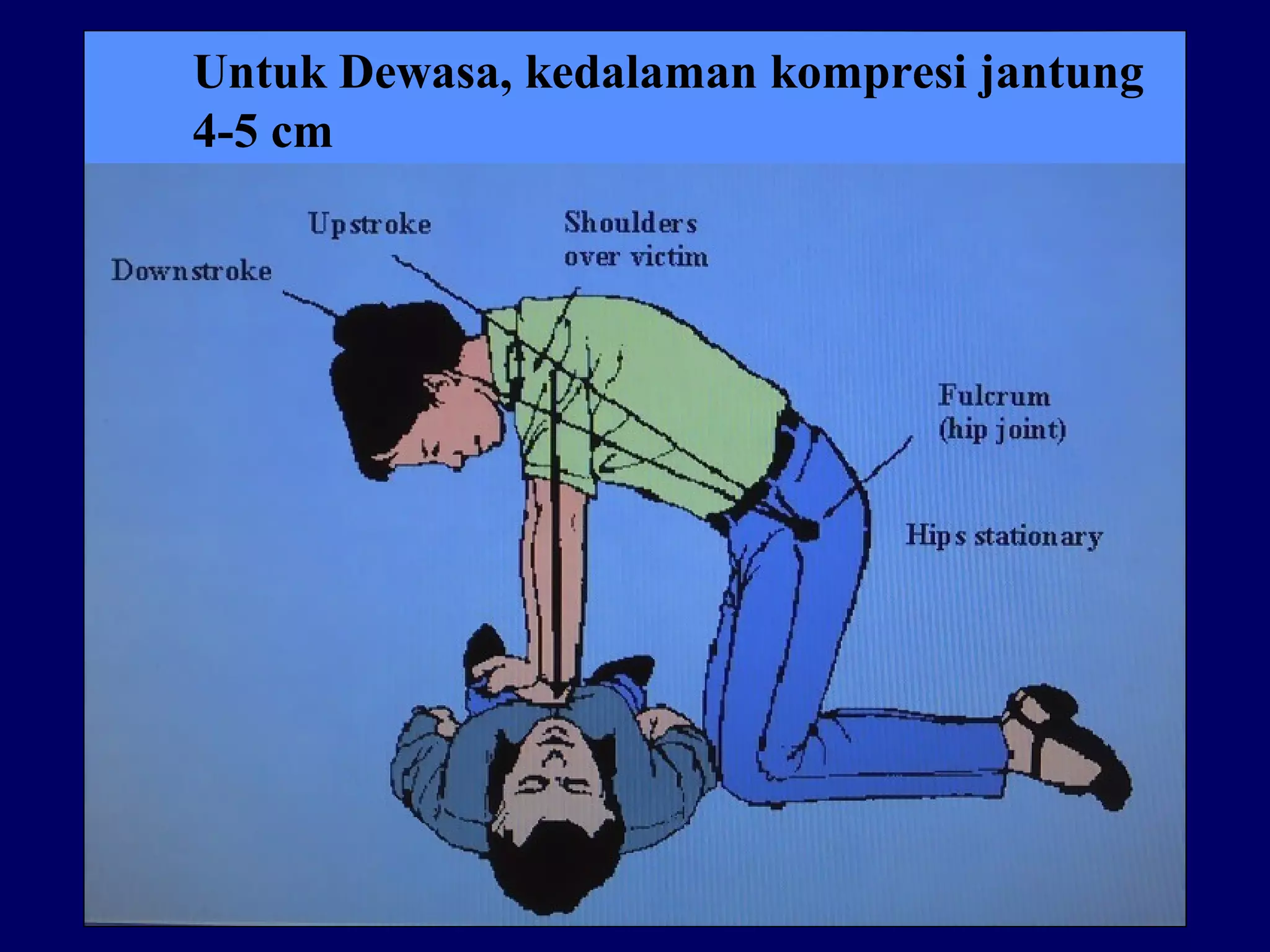 Cardiopulmonary Resuscitation (CPR) atau Resusitasi Jantung Paru-paru | PPT
