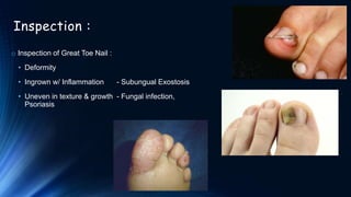 Clinical examination of the foot | PPTX
