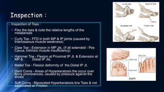 Clinical examination of the foot | PPTX