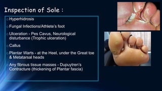 Clinical examination of the foot | PPTX