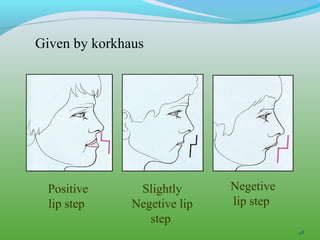 Orthodontic Diagnosis | PPT