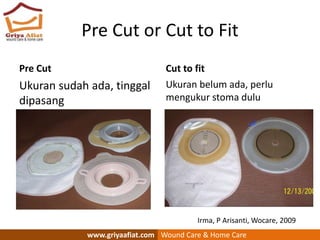 3. pemilihan kantong stoma | PPTX