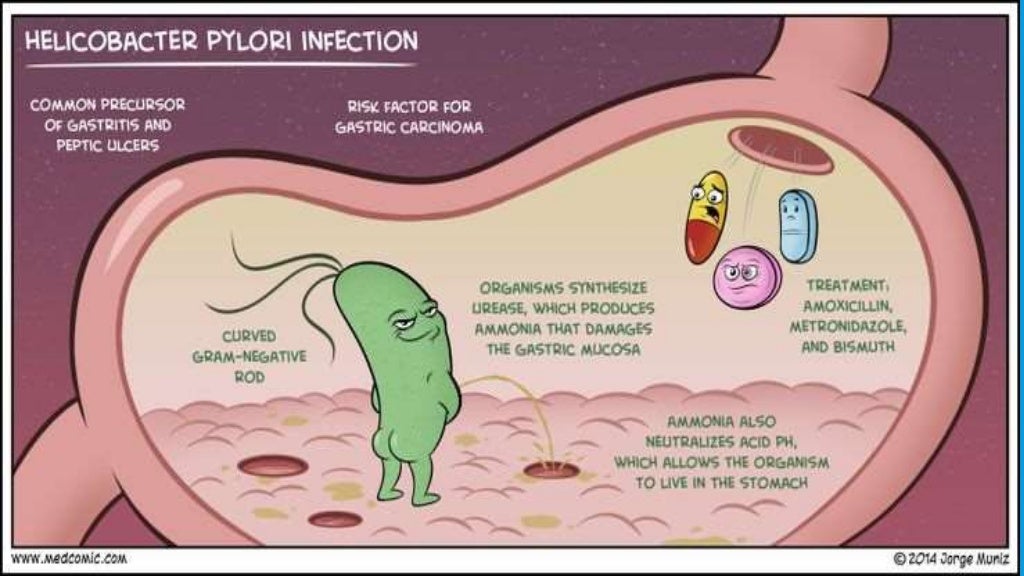 Pathology of Peptic Ulcer Disease