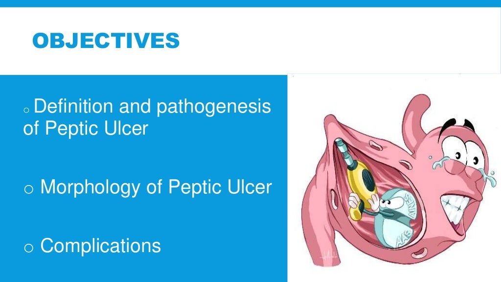 Pathology of Peptic Ulcer Disease