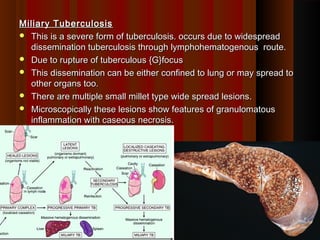 3.pulmonary tuberculosis(tb) | PPT