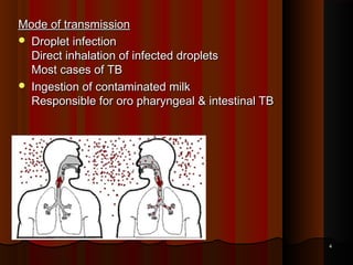3.pulmonary tuberculosis(tb) | PPT