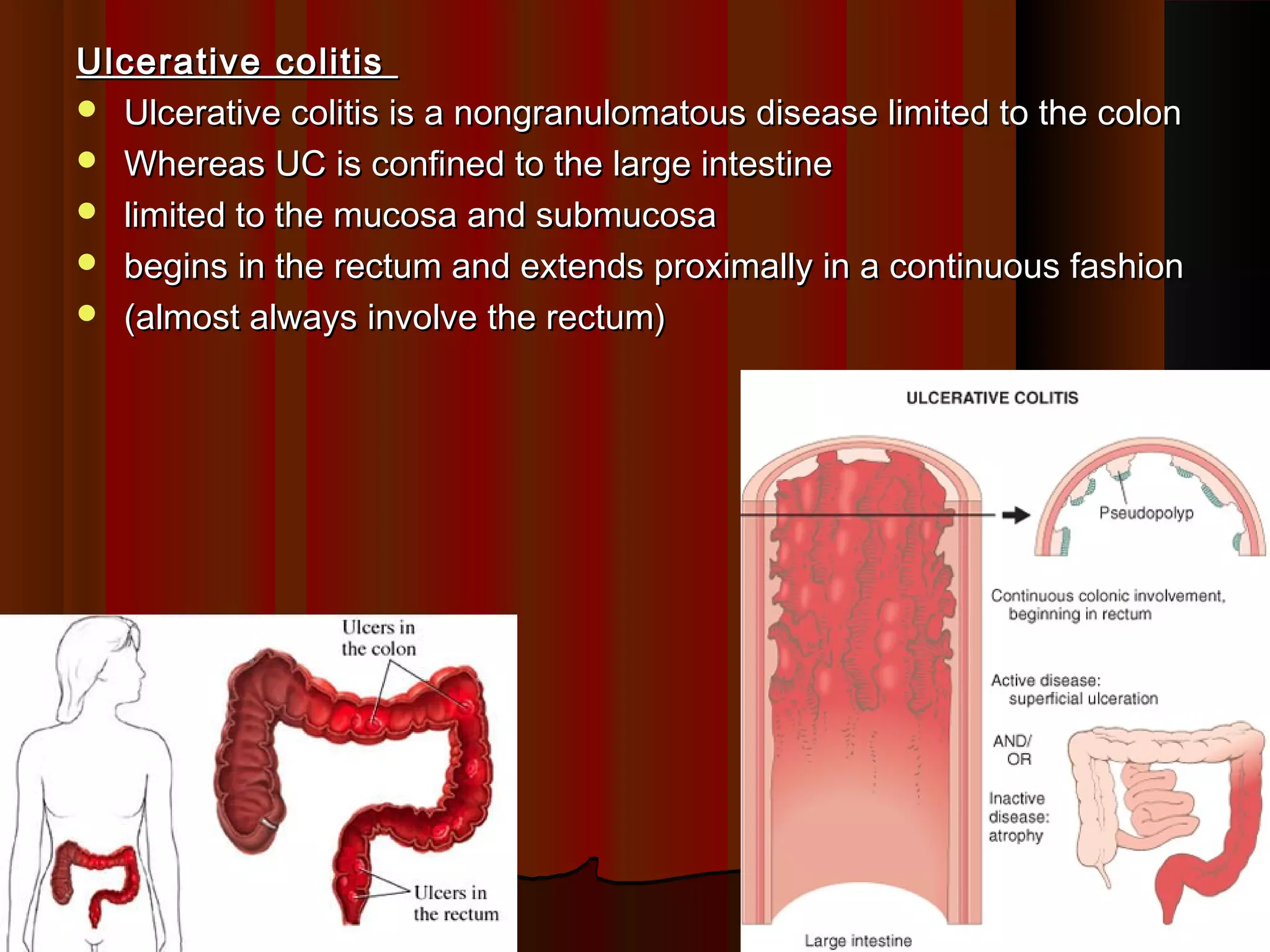 3.intestine | PPT