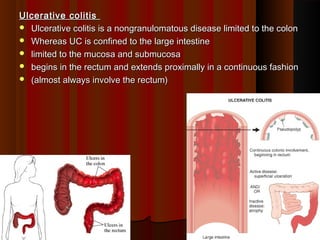 3.intestine | PPT