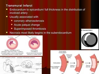 3.Ischemic heart disease( coronary artery disease) | PPT