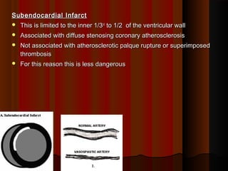 3.Ischemic heart disease( coronary artery disease) | PPT