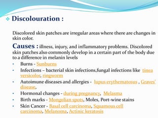 3. Cellulitis | PPTX