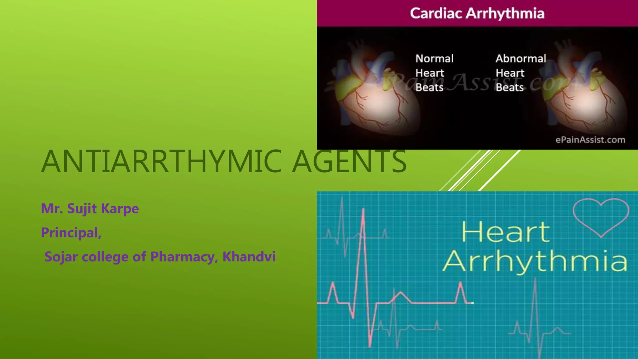 Anti arrhythmic agents | PPT